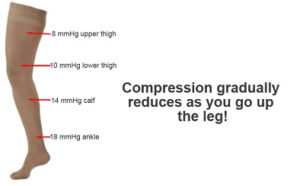 The Complete Guide to the Best Compression Socks for Ankle Swelling