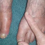 Compression Tubes For Legs - Complete Guide (with Pictures)