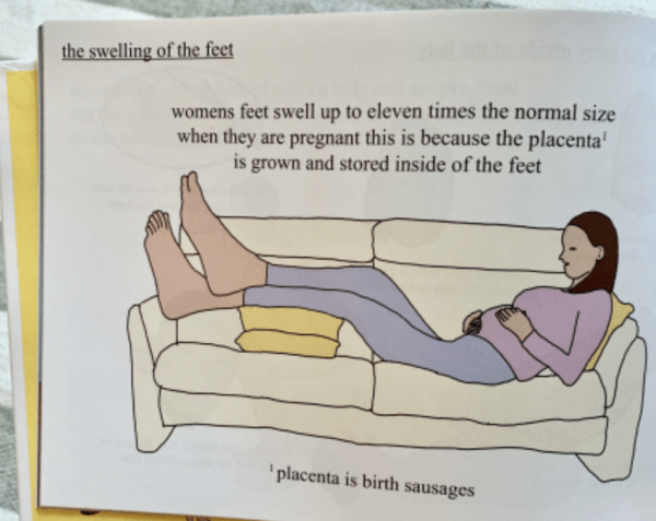 Therapeutic Socks - Everything You Should Know about Compression Socks